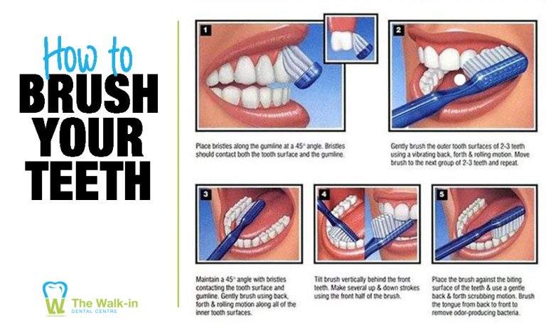 How to Brush your Teeth - The Walk-in Dental Centre - Dentist Dianella ...